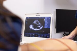 Transthoracic Echocardiography (TTE) - Capital Heart Centre