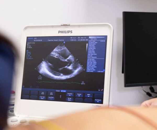 Transthoracic Echocardiography (TTE) - Capital Heart Centre